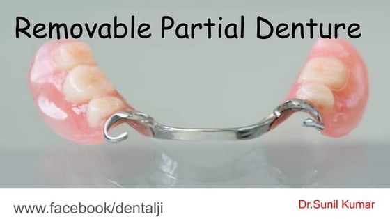 Removable partial denture | PPT