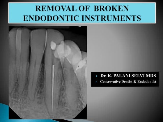 Extraction of retained roots. | PPT