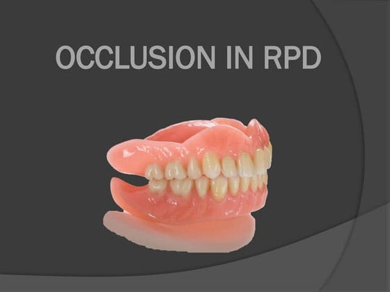 Occlusal relationship in_rpd__prostho_ | PPT