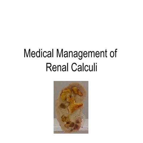 Renal Calculi | PPT