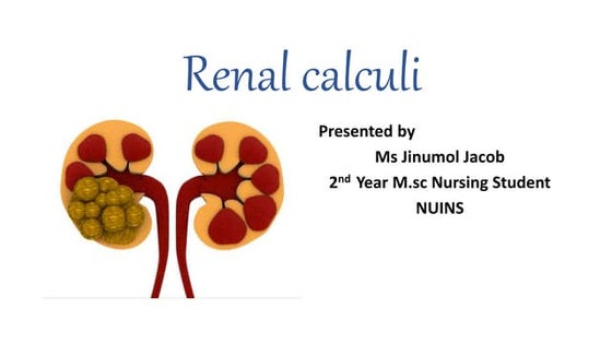 Presentation kidney-stone final | PPTX