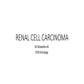 Renal carcinoma and its managment.pptx new | PPTX