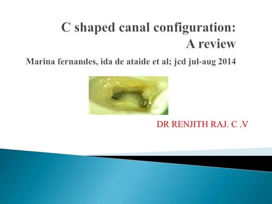 C shaped canal | PPTX