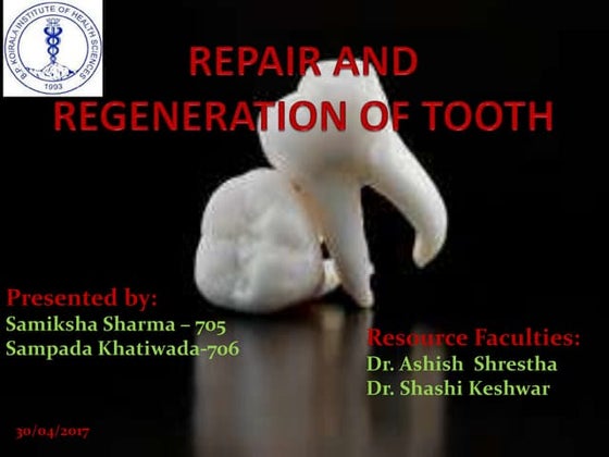 Tertiary Dentin: Reactionary/Response and Reparativ | PDF
