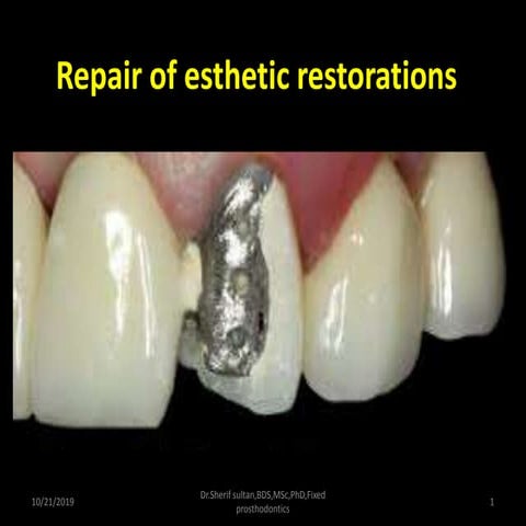 Repair of esthetic restorations [autosaved] | PPTX