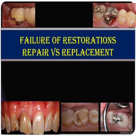 REPAIR AND RESTORE OF OF ALL DENTAL RESTORATION | PPTX