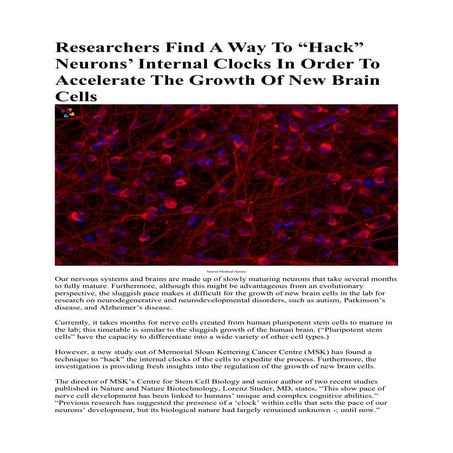 The Growth Of New Brain Cells: Researchers Find A Way To "Hack" Neurons ...