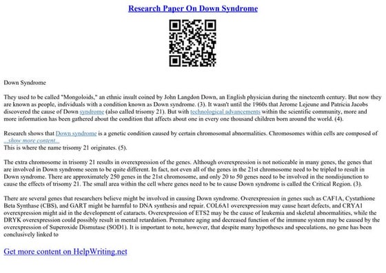 Down Syndrome (Trisomy 21) | PDF