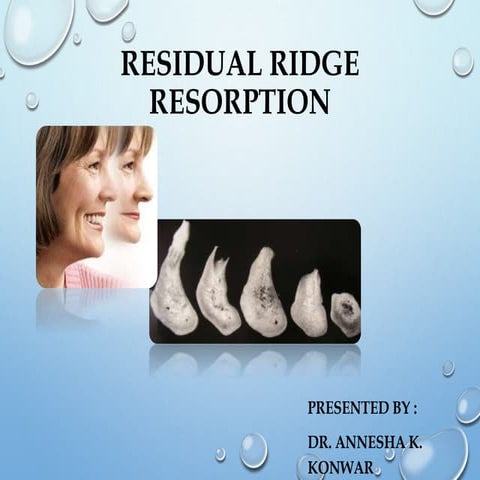 Residual ridge resorption | PPTX