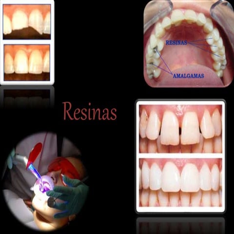 Clasificación de Resinas, componentes, usos | PDF