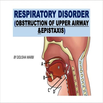 OBSTRUCTION OF UPPER AIRWAY AND EPISTAXIS.pdf