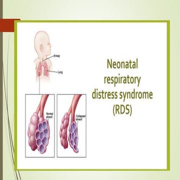 Respiratory distress syndrome | PPTX