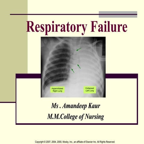 Respiratory failure | PPT