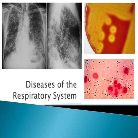 Respiratory system diseases | PPTX