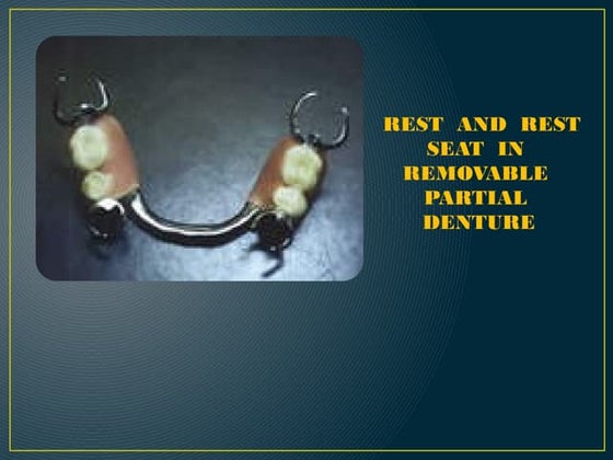 REST AND REST SEATS in prosthodontics ppt | PPT