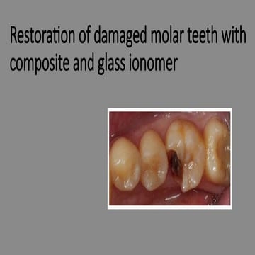 Restoration of damaged molar teeth with composite and.pptx