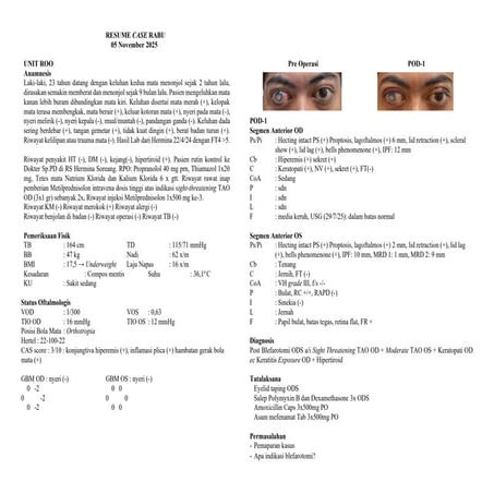 Kasus Ocular Dextra et Sinistra Katarak Imatur | PPTX