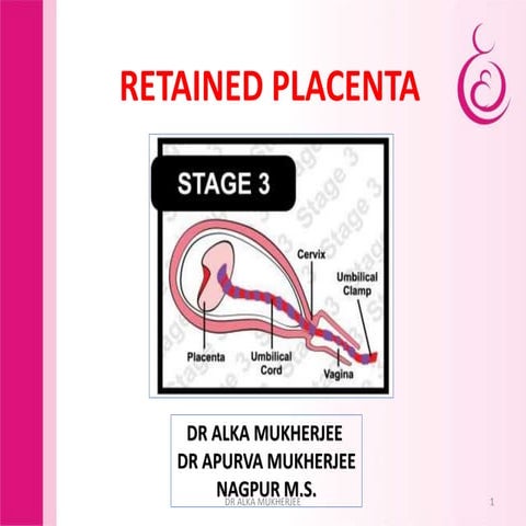 Retained placenta by dr alka mukherjee & dr apurva mukherjee | PPTX