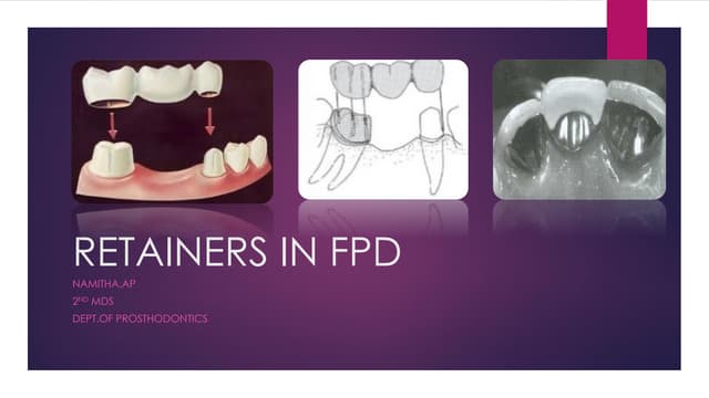 Retainers In Fpd Fixed Partial Dentures Pdf Copy Ppt