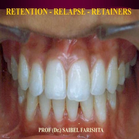Retention Relapse-Retainers | PPT | Dental Health | Diseases and Conditions