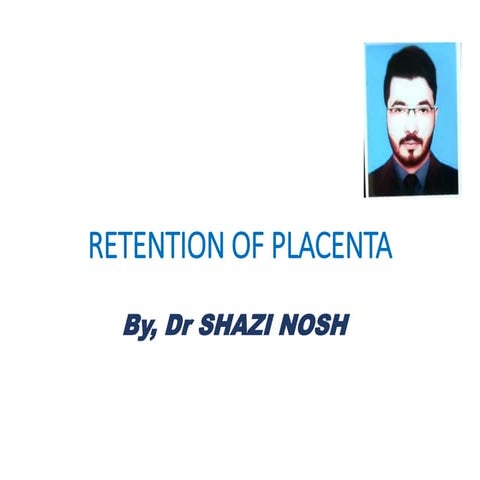 Retention Of Placenta | PPTX