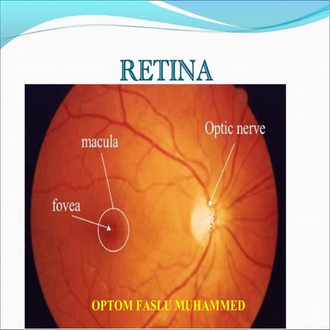Retina | PPT