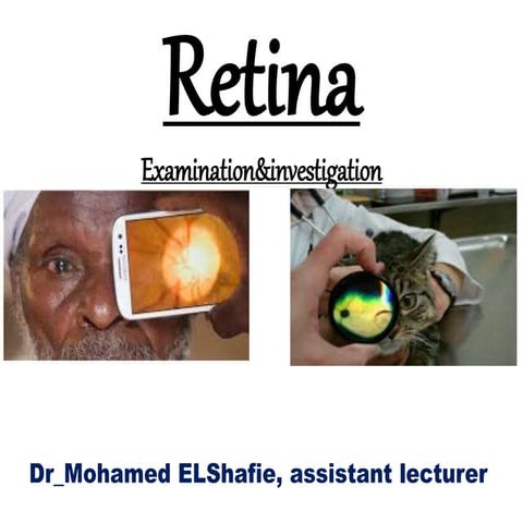 Retina. examination&investigation | PPTX