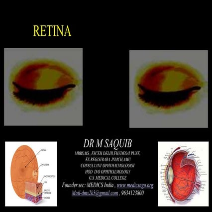 Retina | PPT