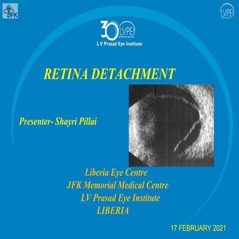 Retina Detachment.pptx