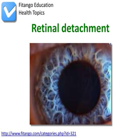 Retinal detachment | PPTX