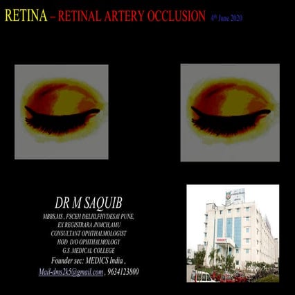 RETINAL ARTERY OCCLUSION , DR SAQUIB | PDF