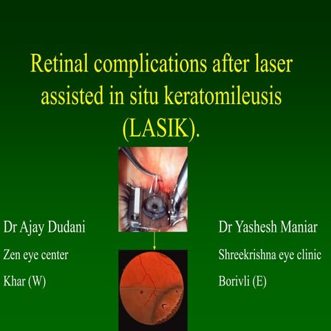 Laser Assisted In Situ Keratomileusis