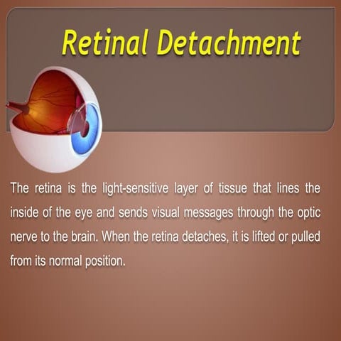Retinal detachment | PPT