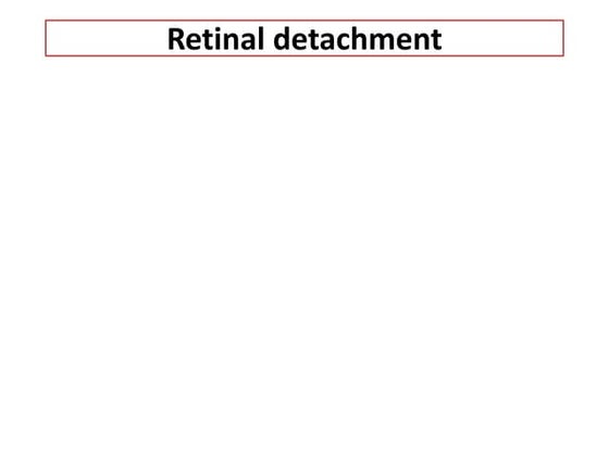 Retinal detachment | PPTX | Eye and Vision Conditions | Diseases and Conditions