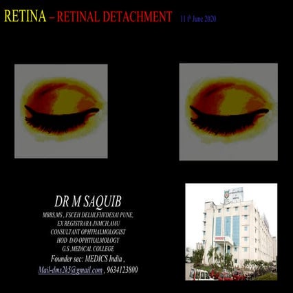 Retinal detachment | PDF