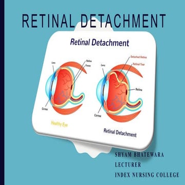 Retinal detachment | PPTX