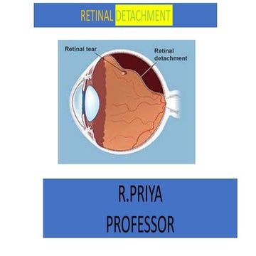 Retinal detachment | PPTX