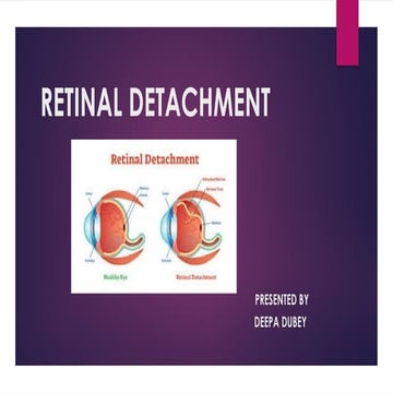 Retinal detachment & their management.pptx