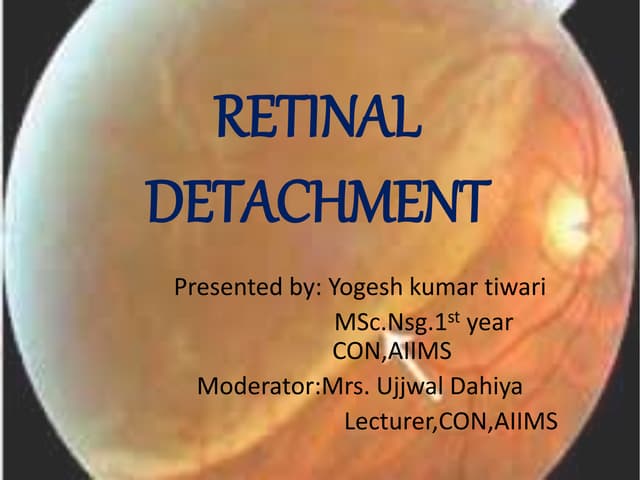 Ophthalmia Neonatorum or Neonatal Conjunctivitis | PPTX