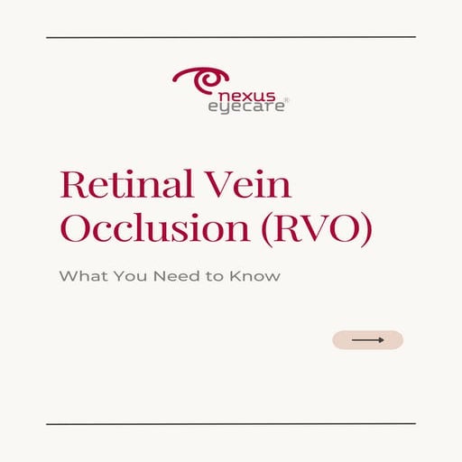 Retinal Vein Occlusion (RVO) – What You Need to Know! | PDF