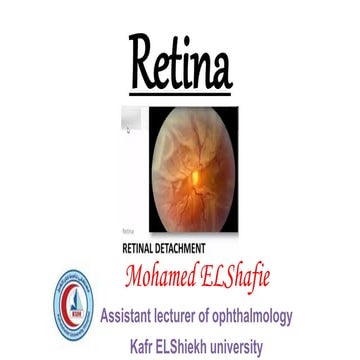 Retina vascular sclerosis | PPTX