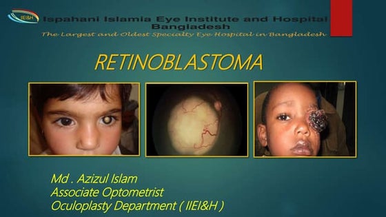 Retinoblastoma | PPT