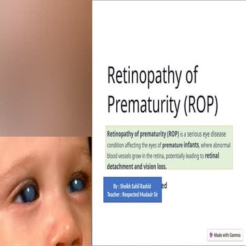Retinopathy-of-Prematurity-ROP.pptx pptt | PPTX