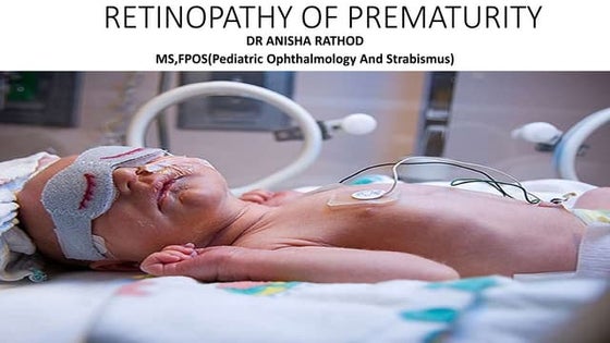 Forced duction test | PPTX | Eye and Vision Conditions | Diseases and ...