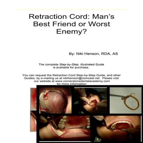 Retraction cords | PPTX