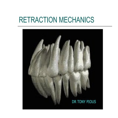 Retraction mechanics | PPT