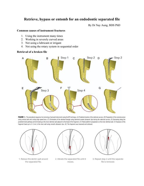Extraction of retained roots. | PPT