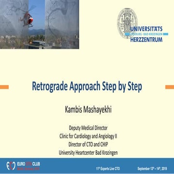 Retrograde approach Step by Step | PDF
