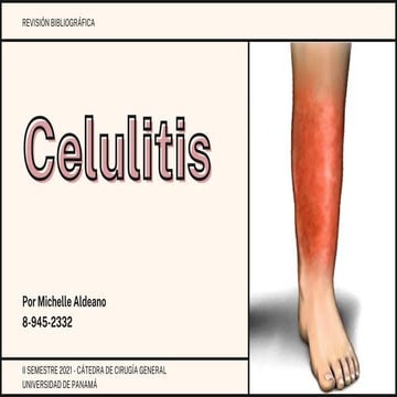Qu Es La Celulitis Infecciosa Y Cmo Identificar Qué Es La Celulitis Y