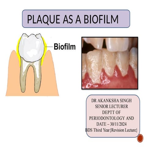 Revision lecture plaque as a biofilm.pptx